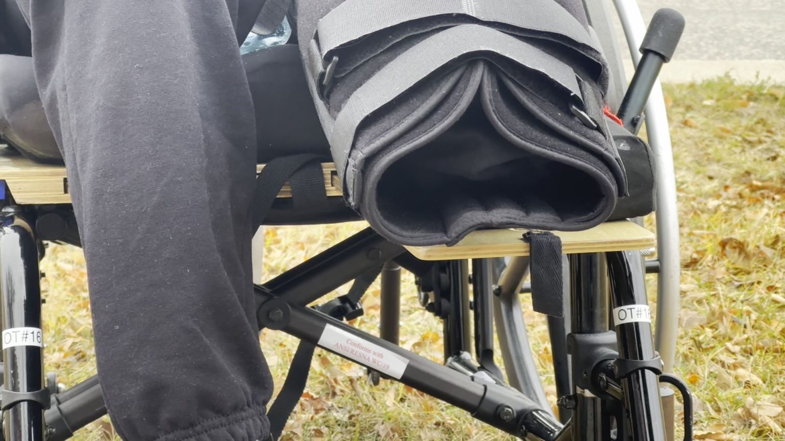 Manitoba man recounts waking up to find wrong leg amputated