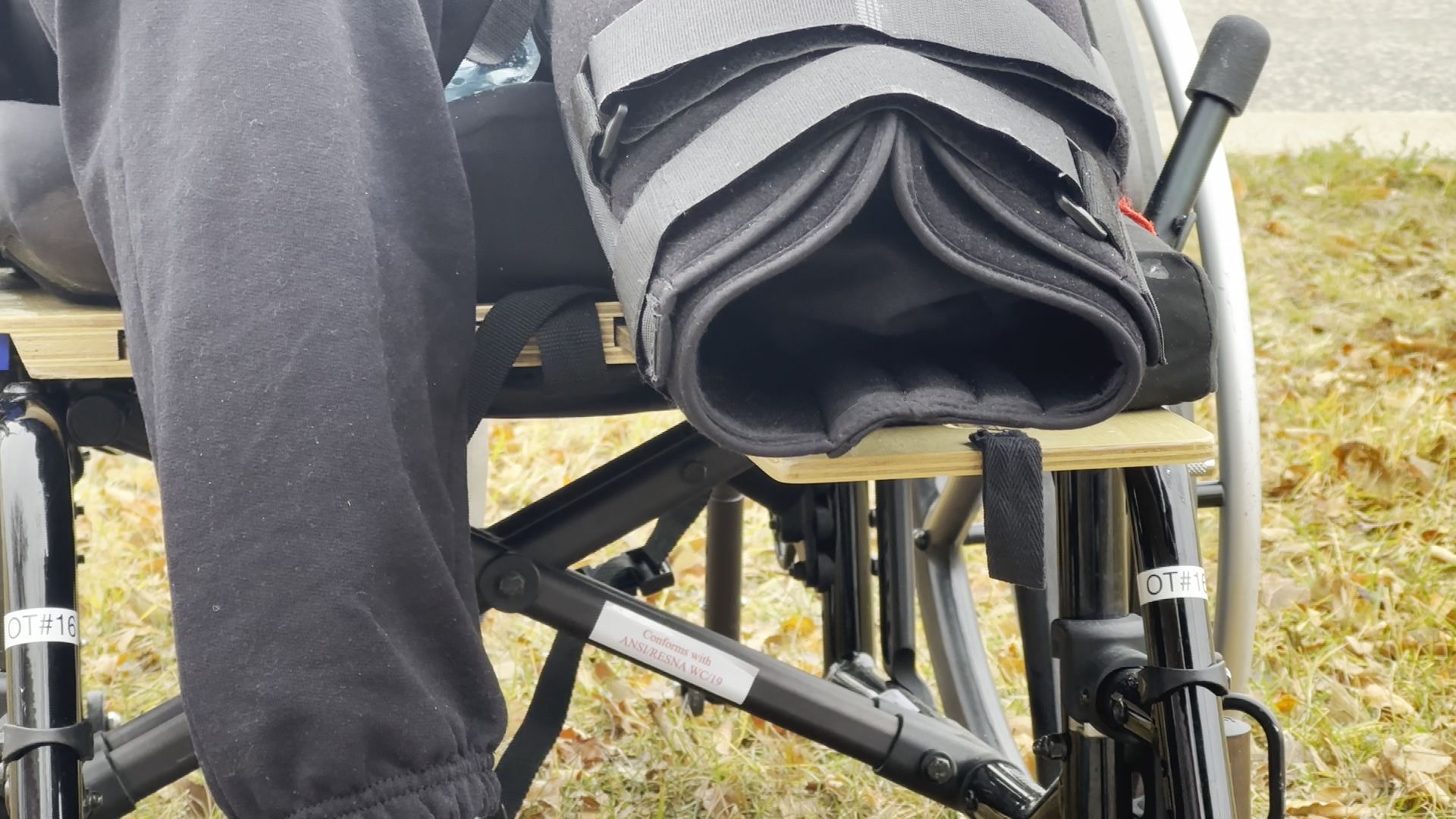 Manitoba man recounts waking up to find wrong leg amputated